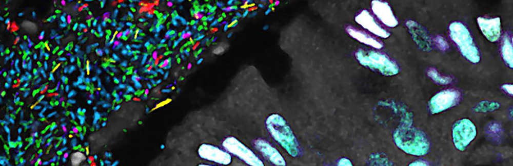 Image of the Week: A Model Microbiome | HHMI BioInteractive | Marine ...