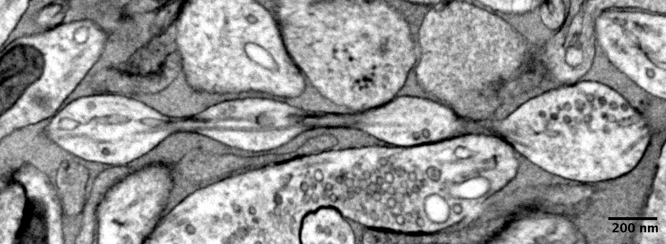 A String of Pearls: Study Challenges Long-Held Beliefs about Nerve Cell ...